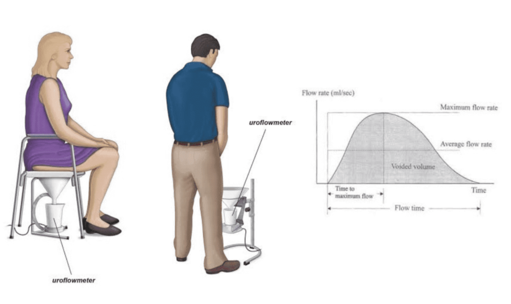 Uroflowmetry vs. Cystometry: Understanding the Differences & Uses